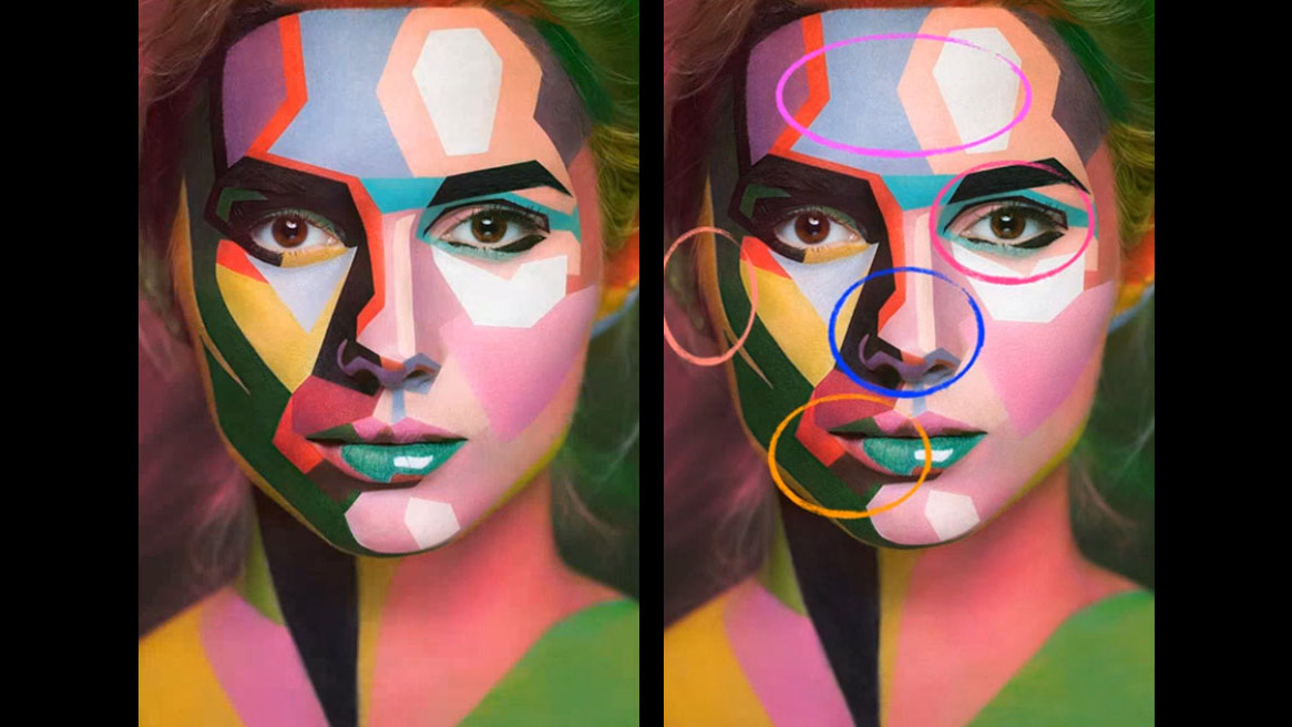 Rétraction après ablation de tumeurs cutanées de la face. P. Pouzoulet ...